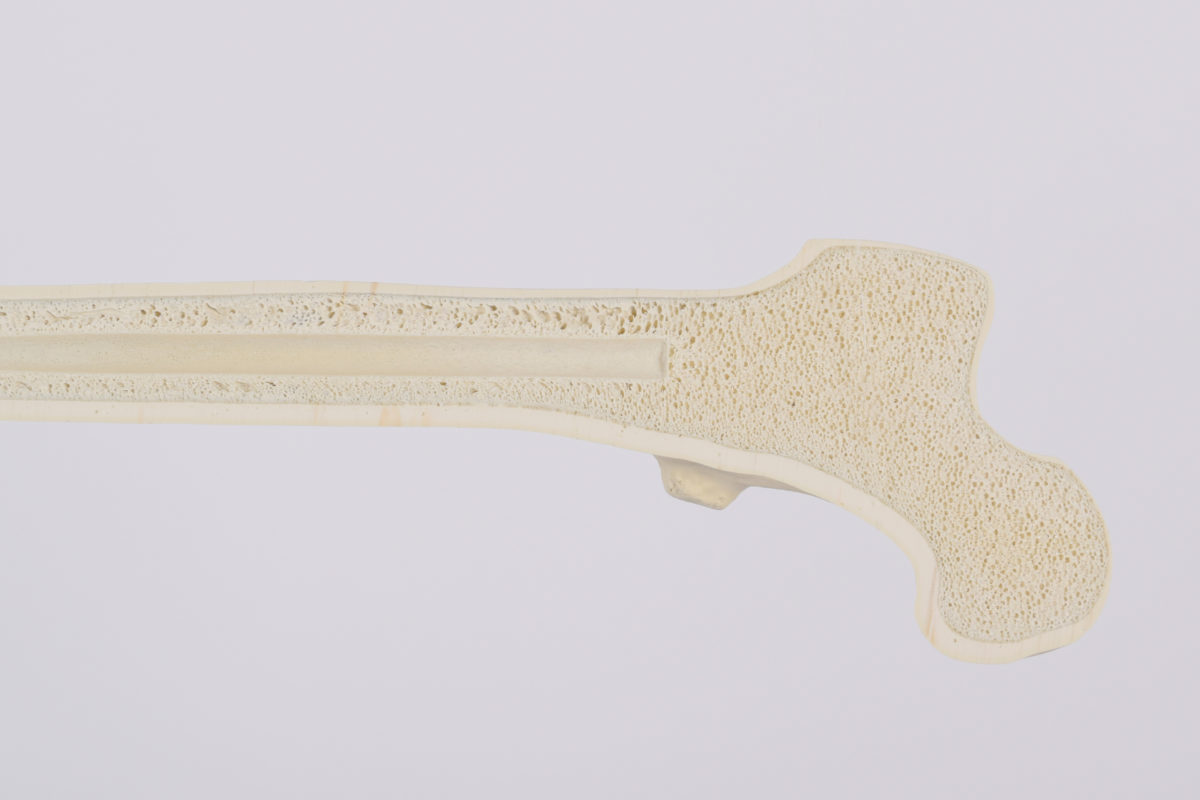 Bone Models - SYNBONE