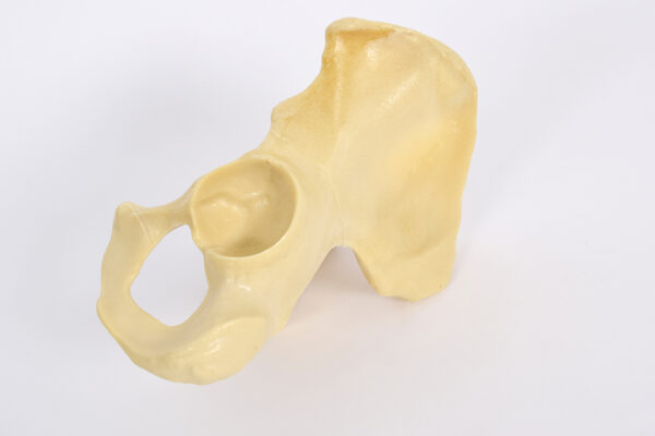 Joint Reconstruction - SYNBONE