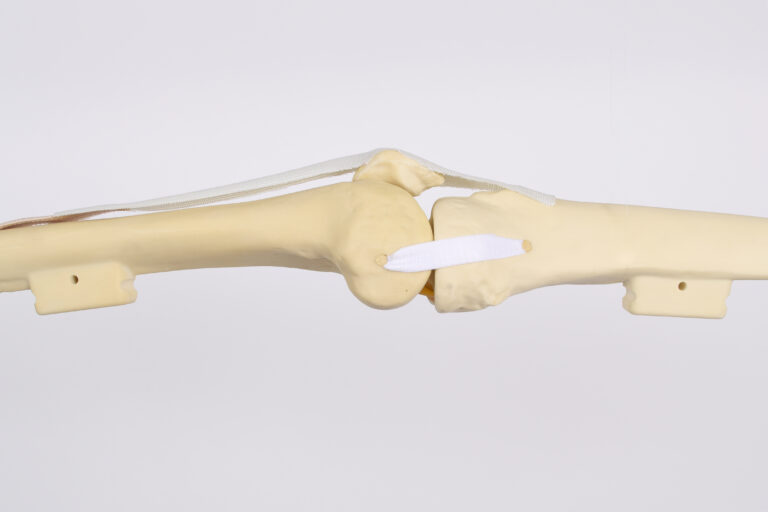 Joint Reconstruction - SYNBONE