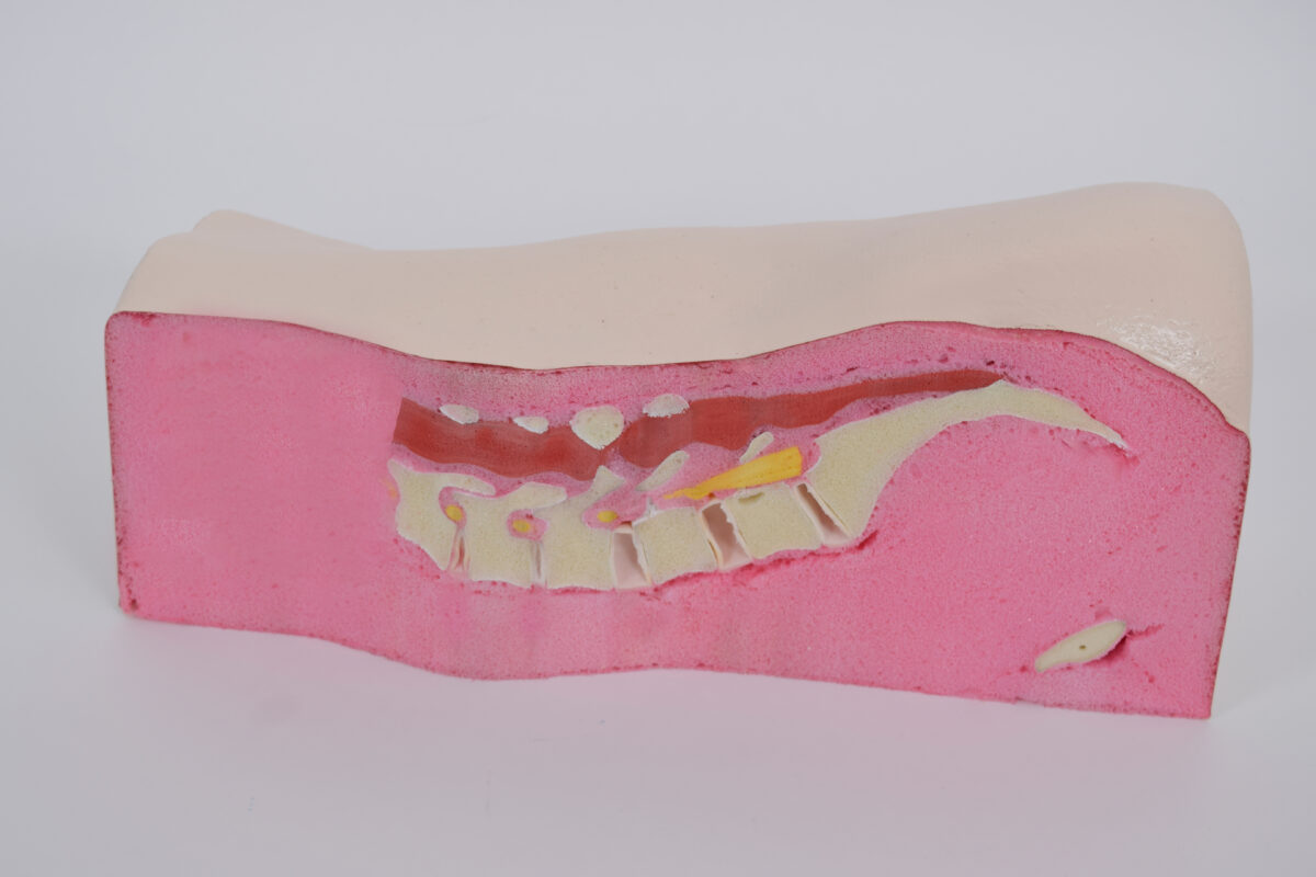 Orthopaedic Models - SYNBONE